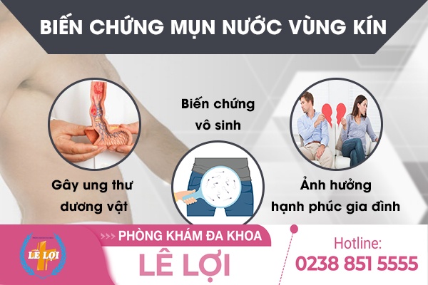Những thông tin cần biết về mụn nước ở vùng kín - Đa khoa Lê Lợi